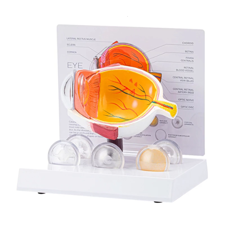 Pathological Eyeball Anatomy Model Human Anatomical Eye Model Teaching ...