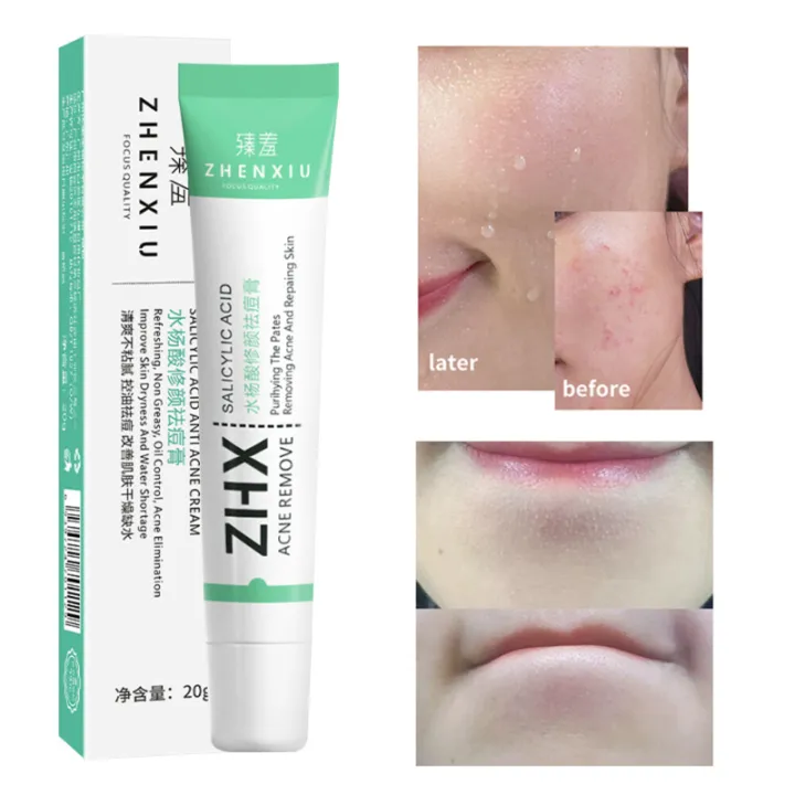 Salicylic Acid Pore Shrinking Refining Cream Remove Black Dots ...