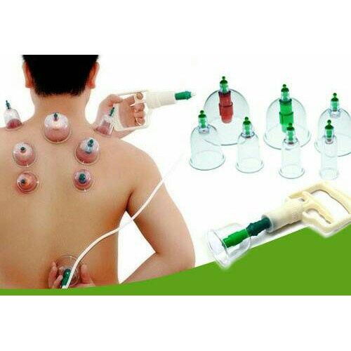 ALAT BEKAM KOP ANGIN ISI 6 Pcs / Kepala Tabung Cup Isap Untuk Mengobati Masuk Angin Dan ...