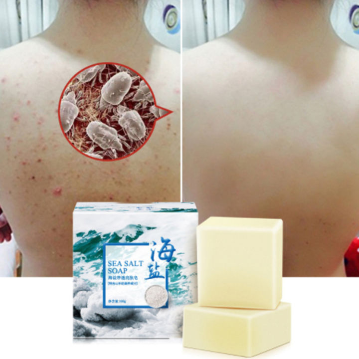 Sea Salt Soap Can Effectively Remove Mites And Improve Skin Problems ...