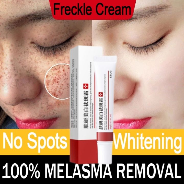 C.three Fast Effective Whitening And Freckle Cream Remove Melasma Acne ...