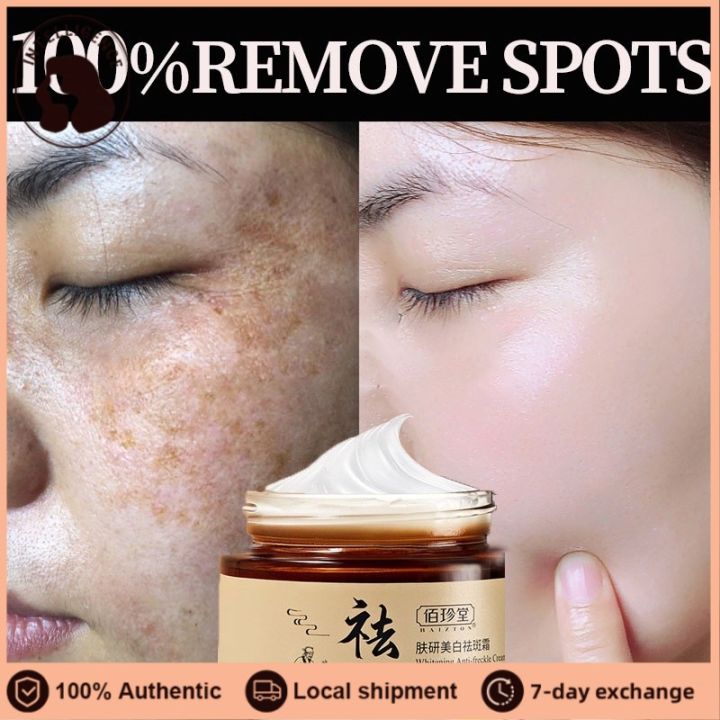🎀🎀IE Genuine Melasma remover cream original 30g Whitening pekas cream ...