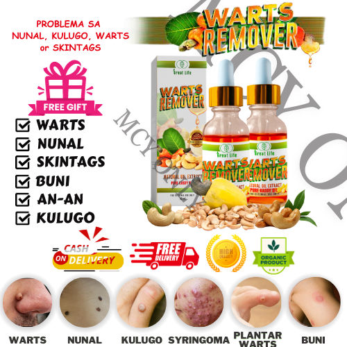 Warts Remover Original Cream Pure Kasoy Oil Pantanggal ng Warts, Nunal ...