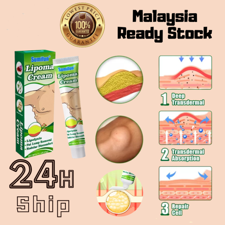 Lipoma Cream Ubat Benjolan Ointment Remove 36 Kinds Of Subcutaneous ...