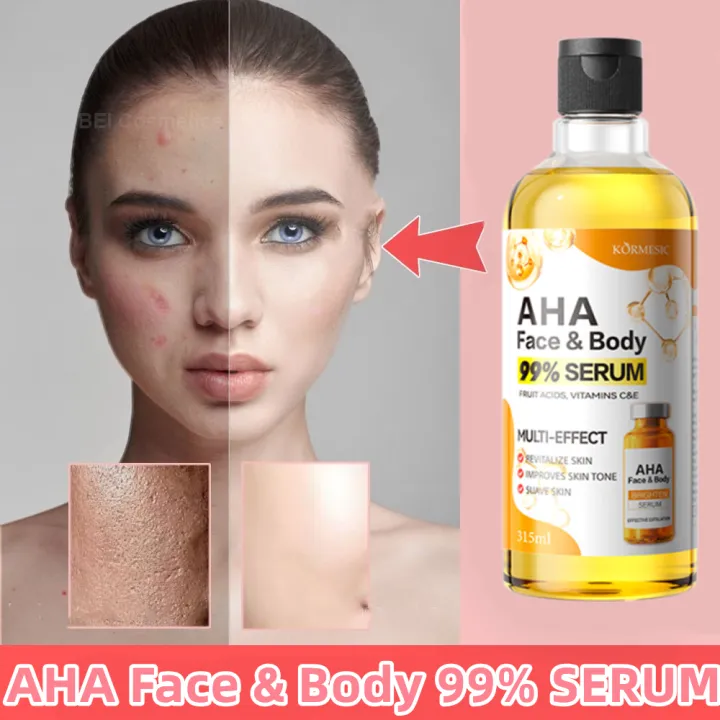 Aha Face Body Serum Whitening Niacinamide Aha 99% Moisturizing Melasma ...