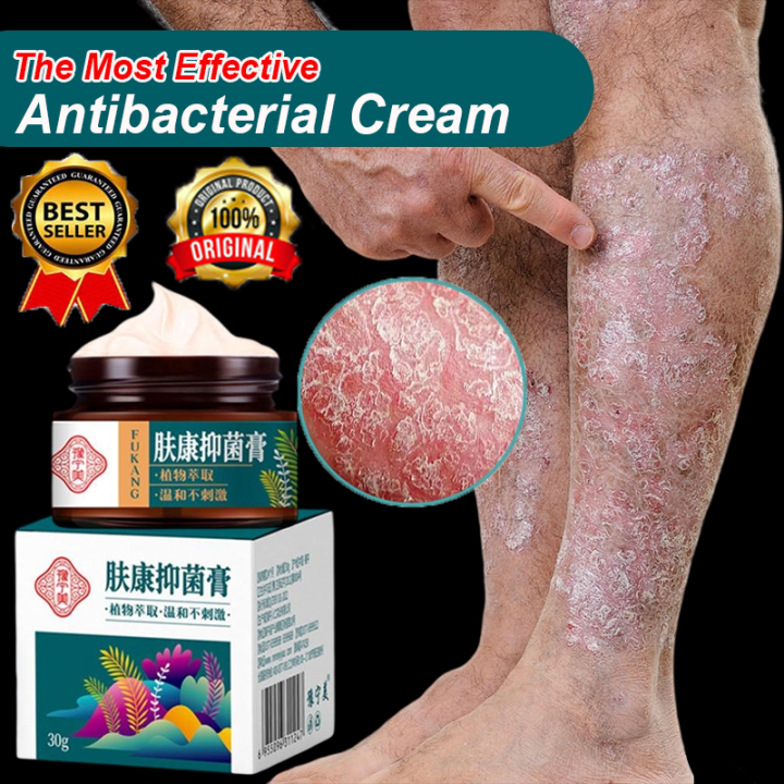 Itchy Skin Cream Itching Of Inner Thigh Anti Itch Psoriasis Eczema Itch