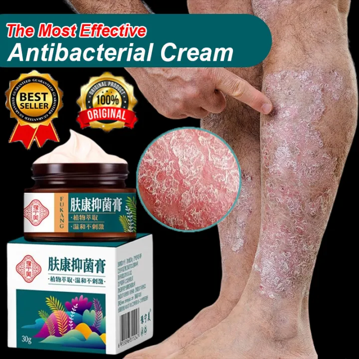 Itchy Skin Cream Itching Of Inner Thigh Anti-Itch Psoriasis Eczema Itch Relief Fungus Ointment ...