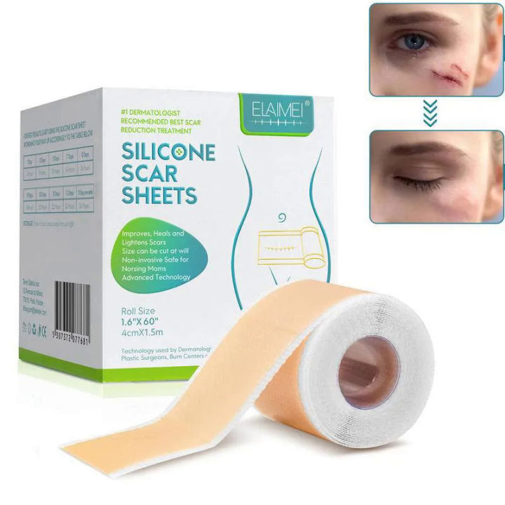 4x150cm Silicone Scar Sheets Painless Scar Repair Tape Patch Effective ...