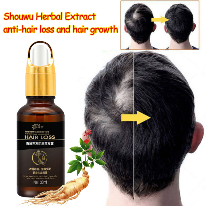 【现货】Ginseng Chinese medicine pure plant anti-hair loss hair growth ...