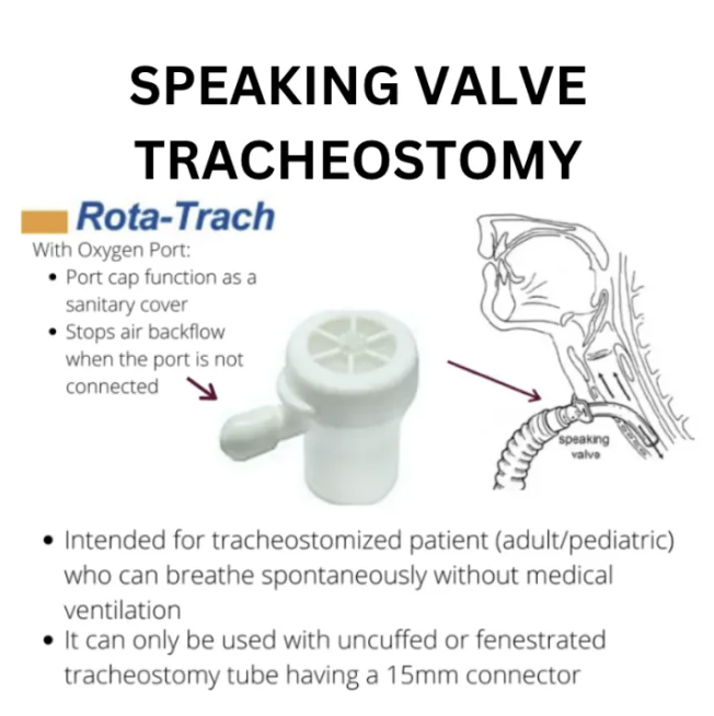 Speaking Valve Tracheostomy | Lazada