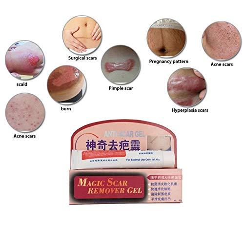 open 24 hours MAGIC SCAR REMOVER GEL 40g | Lazada PH