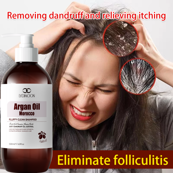 Anti dandruff and anti itch shampoo, seborrheic oil control hair ...