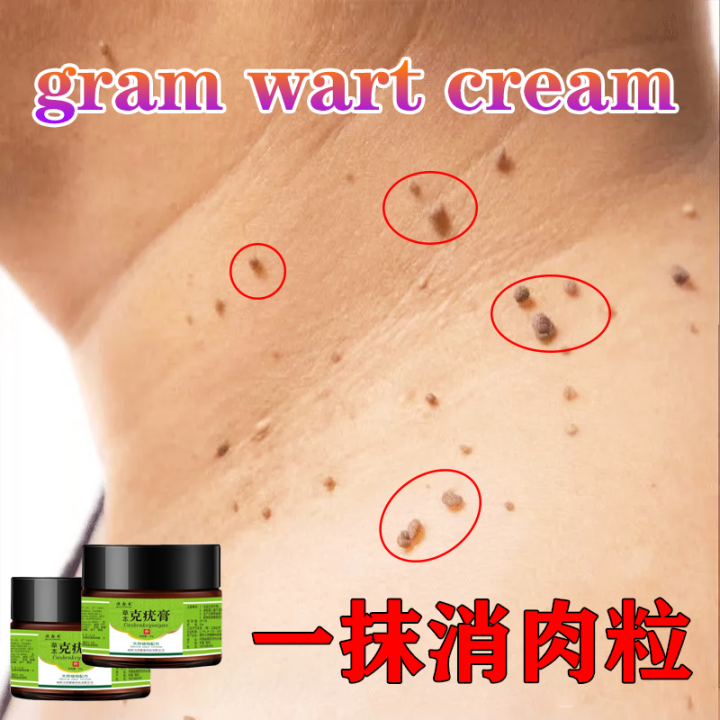 [Buy 3 get 2 free the same style]Wart remover cream Remove the small ...
