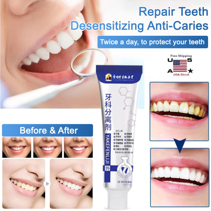 Professional Teeth Separator Toothpaste Dental Grade Formula Anti ...