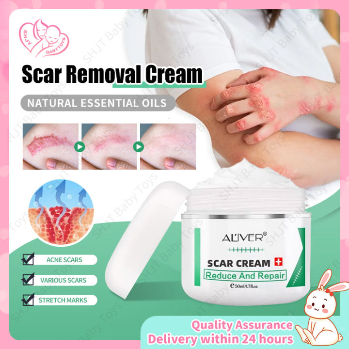 100% Authentic Aliver Scar Remover for Old Scar On Leg Stretch Mark ...