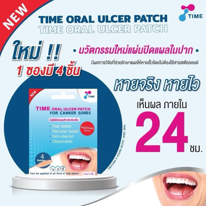 time oral ulcer patch ไทม์ แผ่นแปะแผลร้อนใน | Lazada.co.th