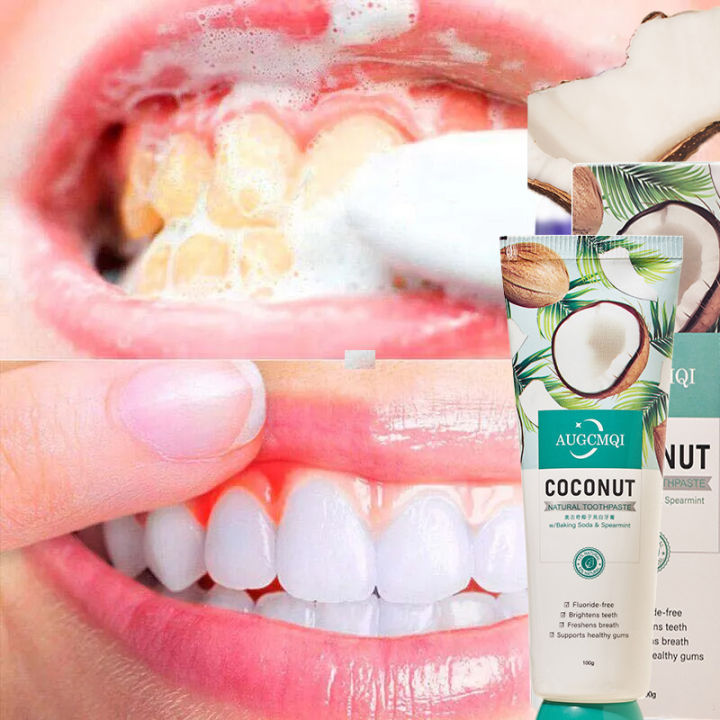 Baking Soda Toothpaste 100g Oral Cleaning Remove Tartar & Stains Fresh ...