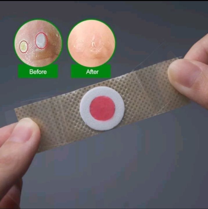 Plaster Kutil / Plaster Mata Ikan dan kapalan isi 6pcs | Lazada Indonesia