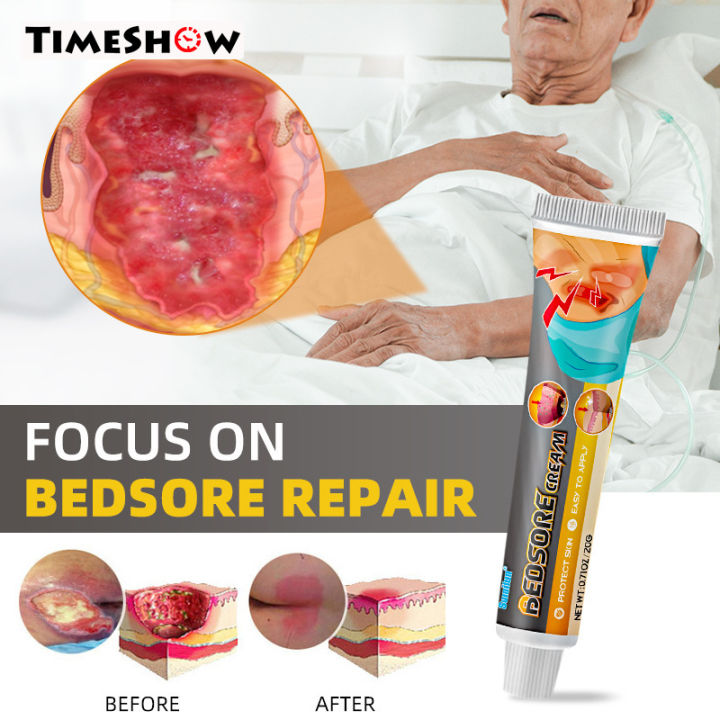 TimeShow Antibacterial Bedsore Cream Wound Healing Rot Skin Herbal Care ...