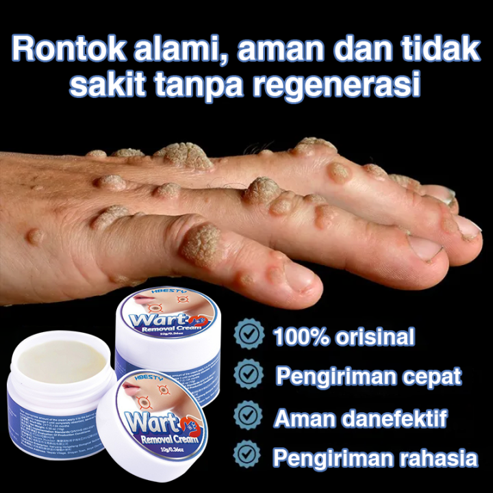 Remover Wart Ointment Salep Kutil Wart Remover Wart Removal Cream Krim ...