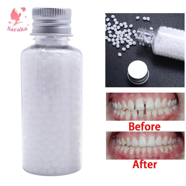 Saraka Thermal Beads Teeth Veneers Moldable for Broken Teeth Uneven ...