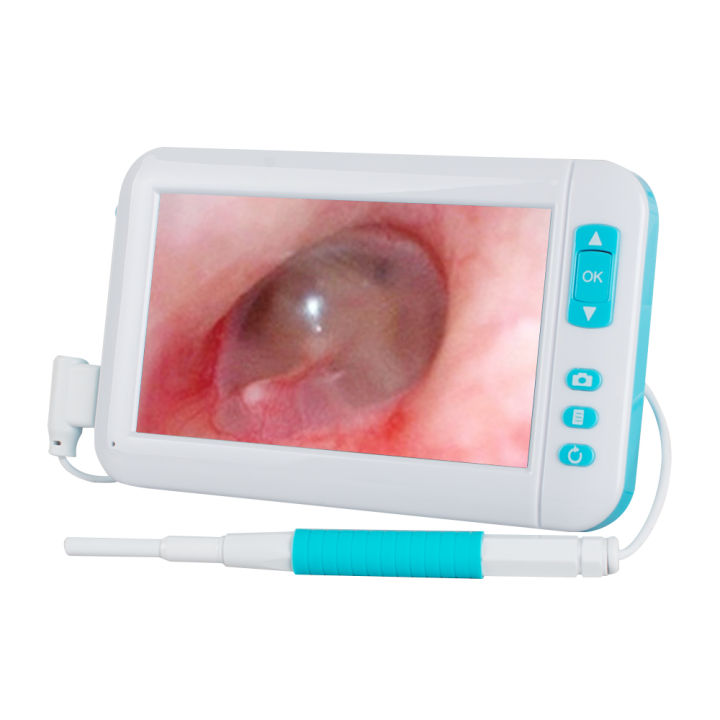 Digital Otoscope Ear Inspection Camera Rechargeable 4.3 inch Color ...