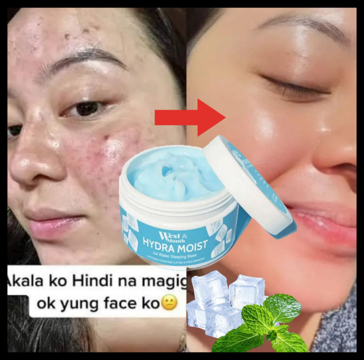 Sleeping moisturizing facial mask relieves inflammation and fights acne ...