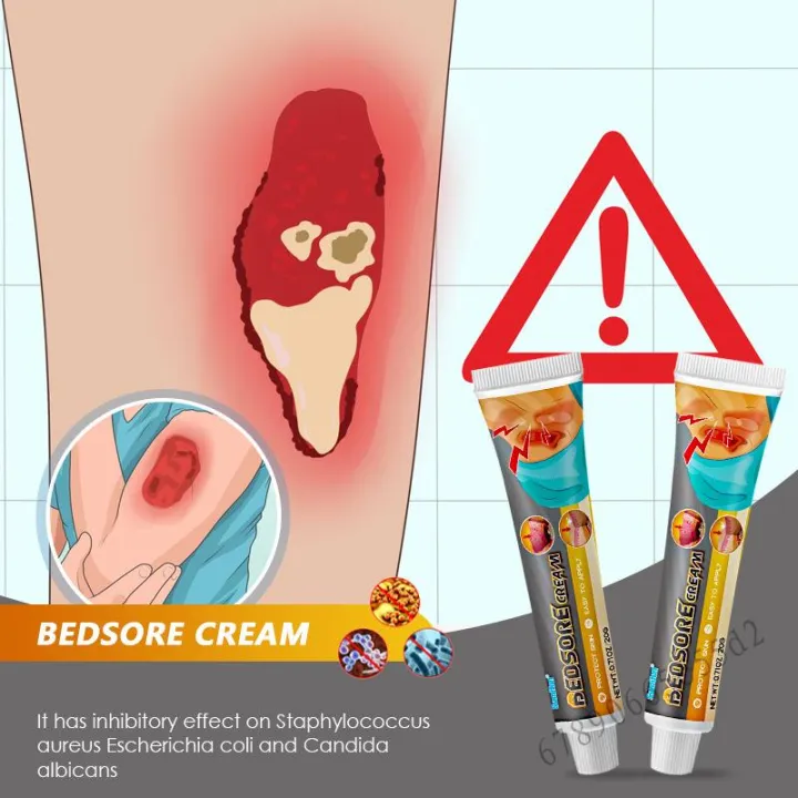 TimeShow Antibacterial Bedsore Cream Wound Healing Rot Skin Herbal Care ...