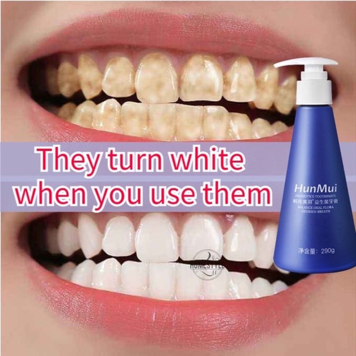 Hunmui Toothpaste Whitening Teeth Toothpaste 290g Teeth Whitening ...
