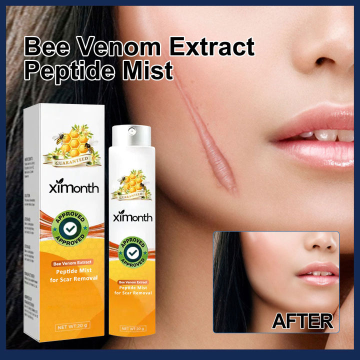 XiMonth Bee Venom Extract Peptide Mist Scar Removal Spray Repaire Old ...