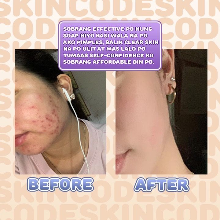 (An) anti aging Ice Candy Whitening and Anti-acne Soap | Lazada PH
