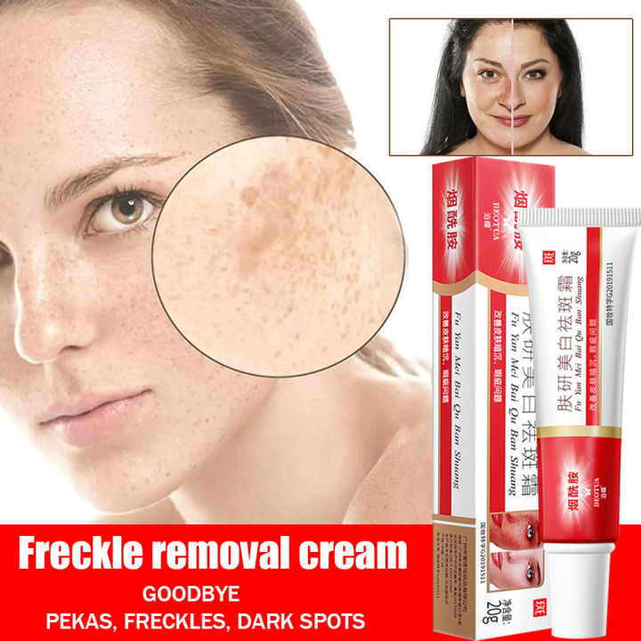 Whitening Freckle Cream 20g Remove Melasma Acne Dark Spot Melanin ...