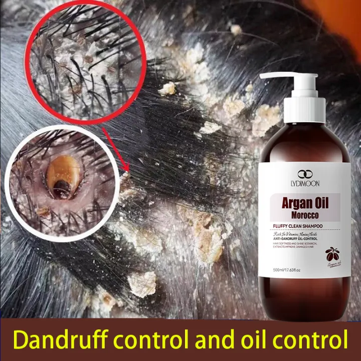 Anti-dandruff, oil-control, fluffy hair shampoo 500ml, long-lasting fragrance, antipruritic ...