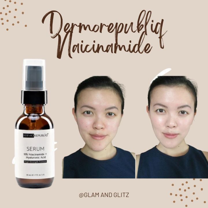 Dermorepubliq 5% Niacinamide + Hyaluronic Acid Sensitive Skin Formula Serum - 30 mL | Lazada PH