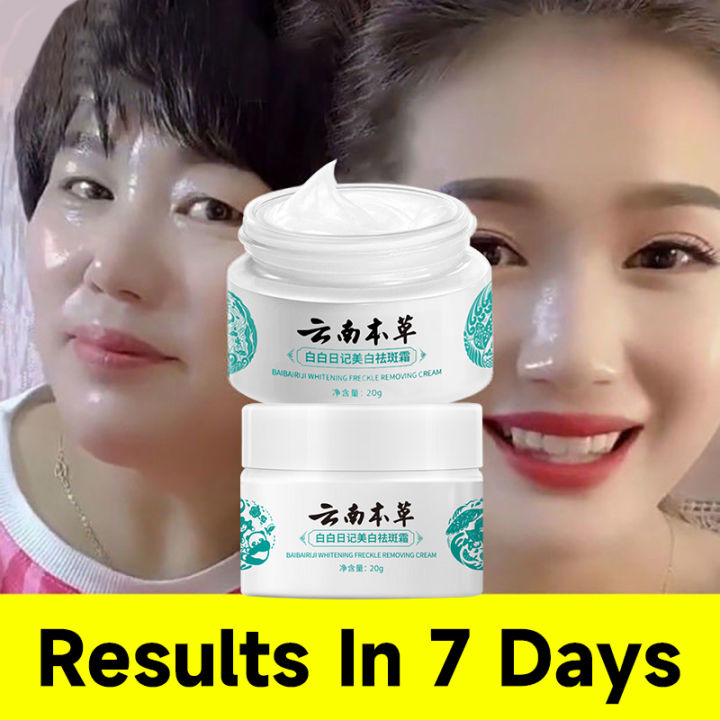 20g Japanese Melasma Cream Yunnan Herbal Whitening Freckle Cream ...