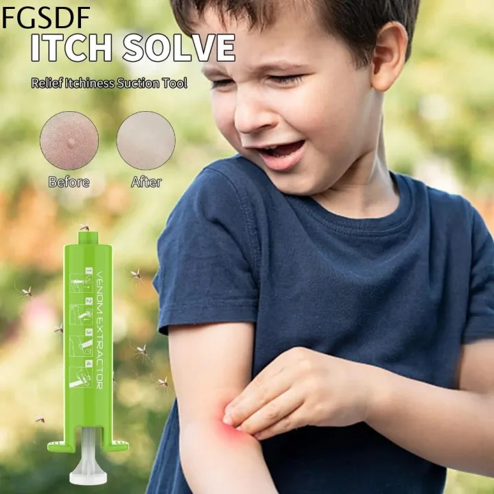 FGSDF Bites Relief Bug Bite Suction Tool Vacuum Natural Itch Relief ...