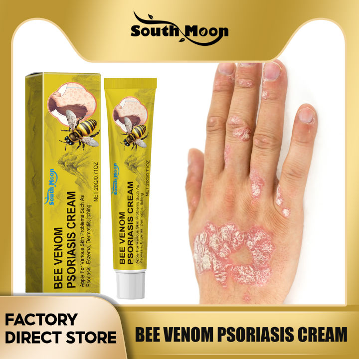 South Moon Bee Venom Psoriasis Cream Treatment Eczema Dermatitis Rash ...