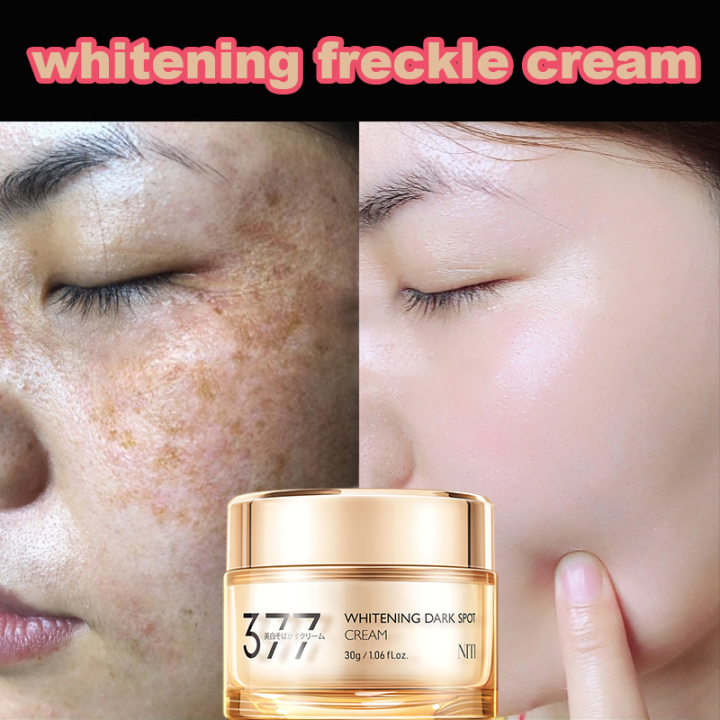 Whitening and freckle removing cream, melasma removing cream, anti ...