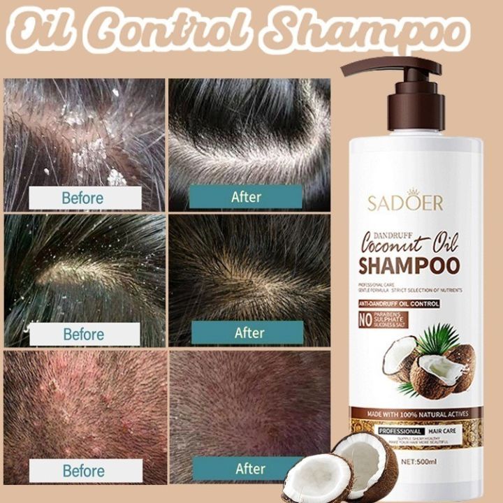 【BUY1TAKE1】SADOER Coconut Oil Moisturizing Hair Care Dandruff Shampoo Refreshing Oil Conditioner ...