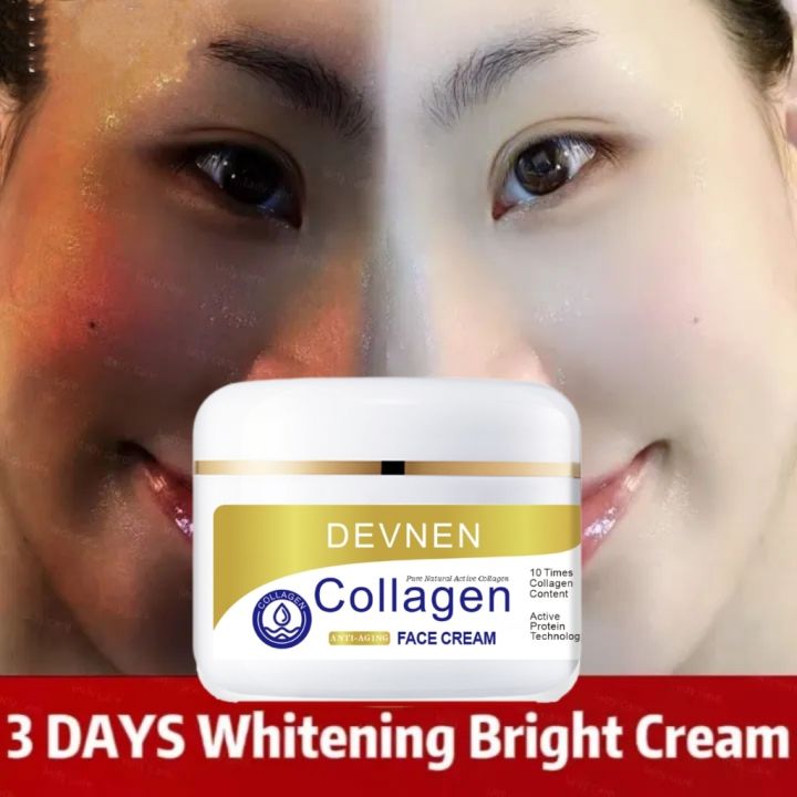 DEVNEN 100% Effective Collagen Melasma Cream Collagen Face Cream ...