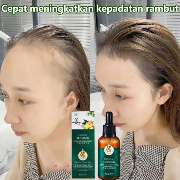 【5.5 Hot Sale】Vitamin jahe rambut , memperbaiki kerusakan , menebalkan ...