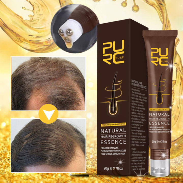 Purc Hair Growth Essence Scalp Treatments Hair Grow Restoration