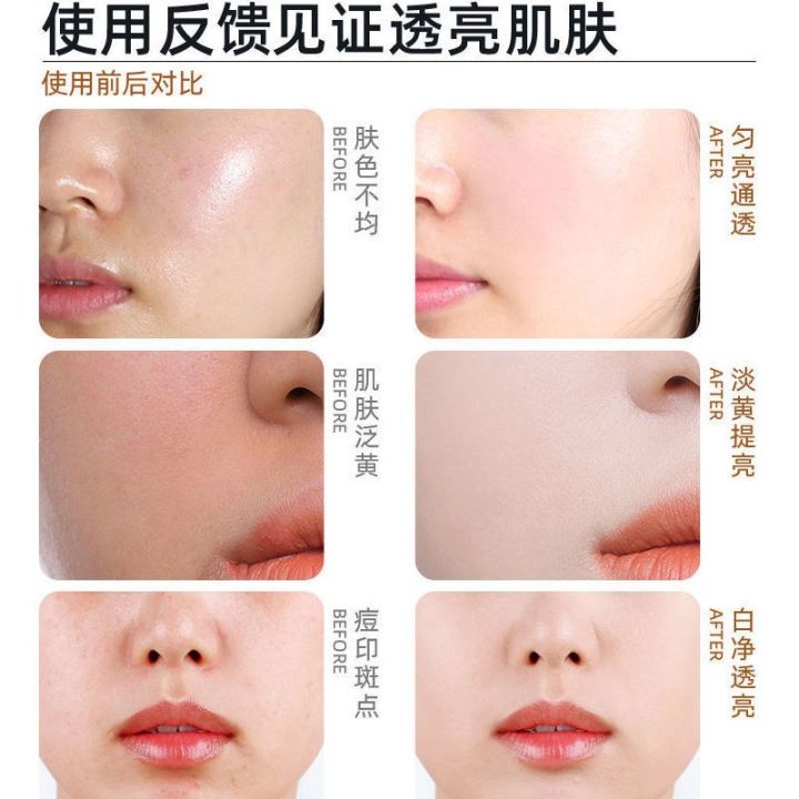 α-Arbutin Essence Water Glowing Bloom Toner Brightens, Moisturizes and ...