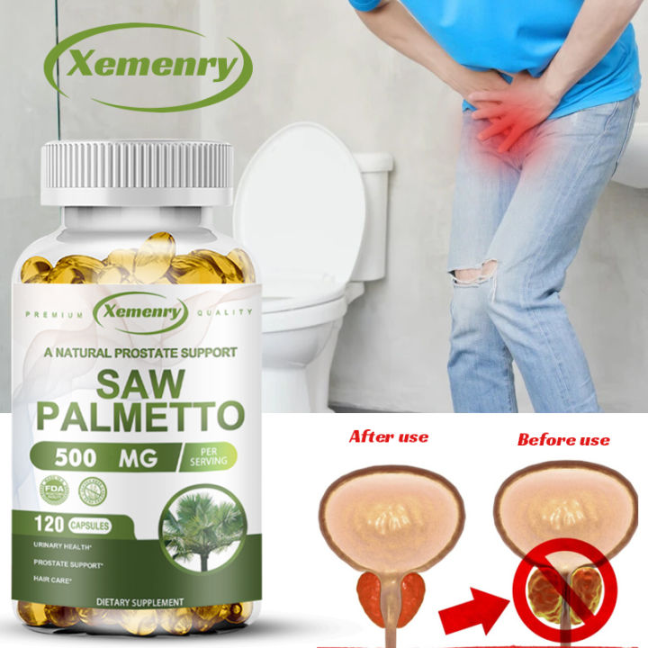 SAW PALMETTO – vitamin for men and women – supports bladder cleansing ...