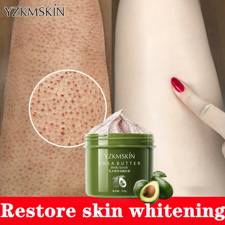 YZKMSKIN Shea Butter Body Scrub Whitening Chicken Skin Remover and ...