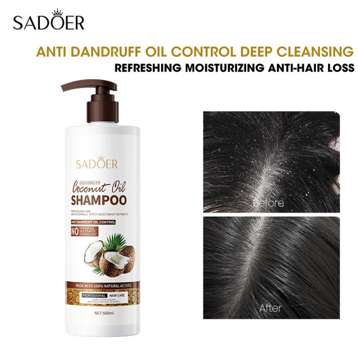 SADOER Coconut Oil Moisturizing Anti Dandruff Shampoo Hair Treatment Refreshing Oil Control ...