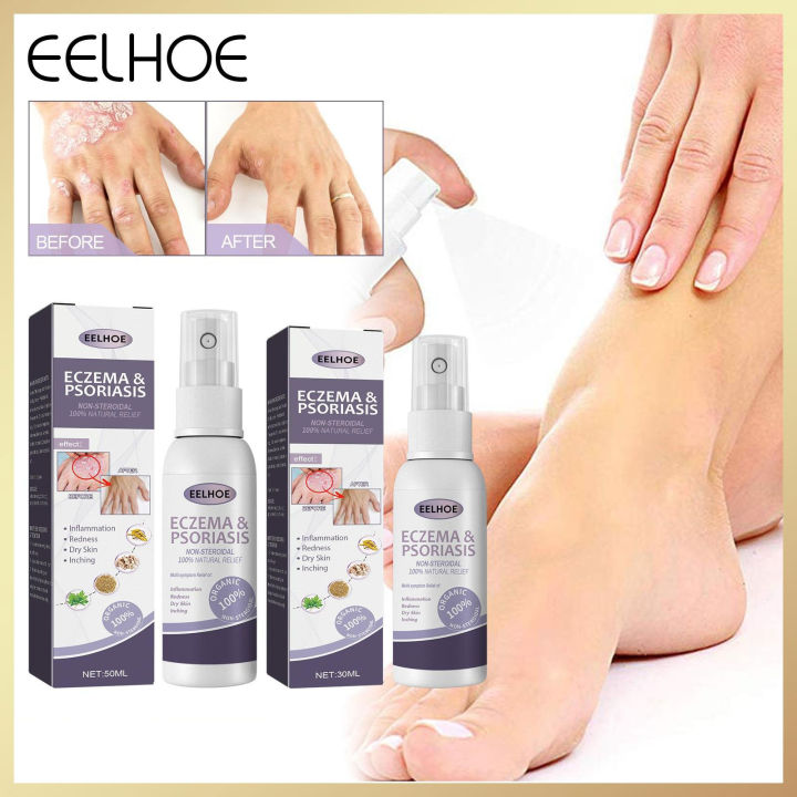 Eelhoe Hand And Foot Moss Spray Plant Formula Hand And Foot Moss Repair ...