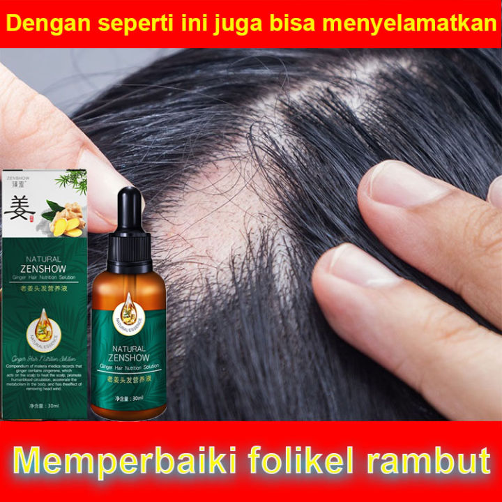 Garansi AsliNATURAL 30ML PENUMBUH RAMBUT Oil Minyak Penumbuh Hair ...