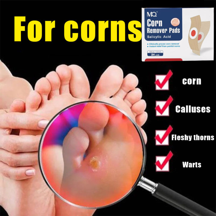 MQ warts remover patch 24 /box Pain relief, remove calluses on hands ...