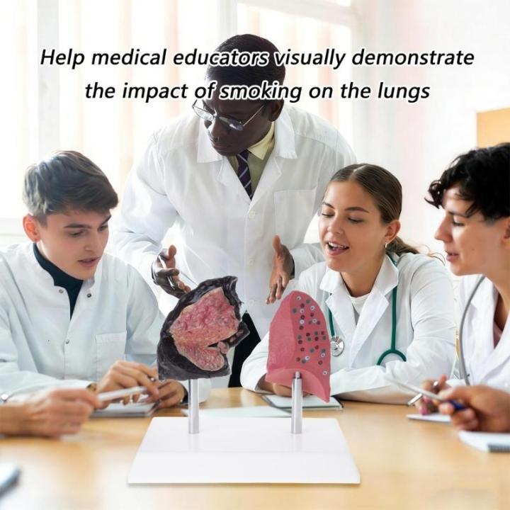 Realistic Puffing Lung Vs Not Smoker Lung Educational Model Permanent ...